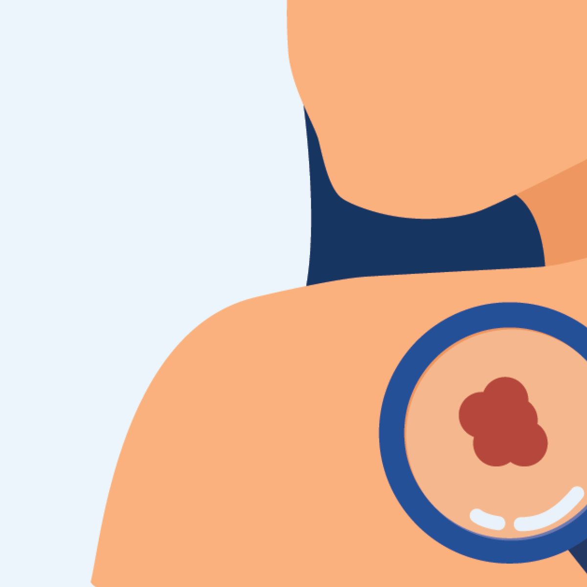 Free Skin Cancer Screenings in May | Lehigh Valley Health Network