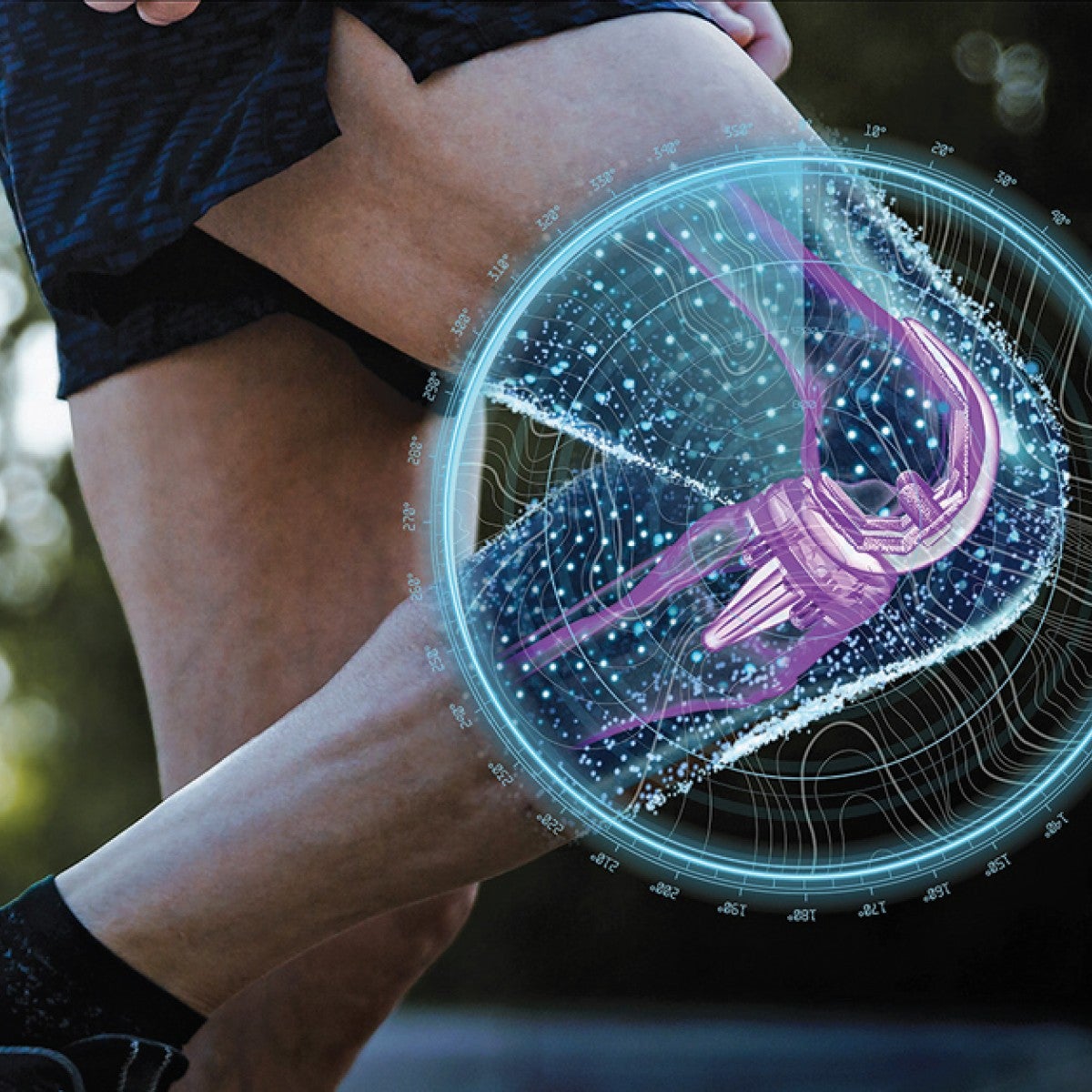 Hazleton Native Brings Robotic Knee Replacement Surgery to the ...