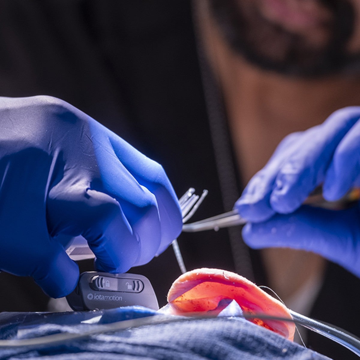 Lehigh Valley Institute for Surgical Excellence Pioneers Use of Robotic ...