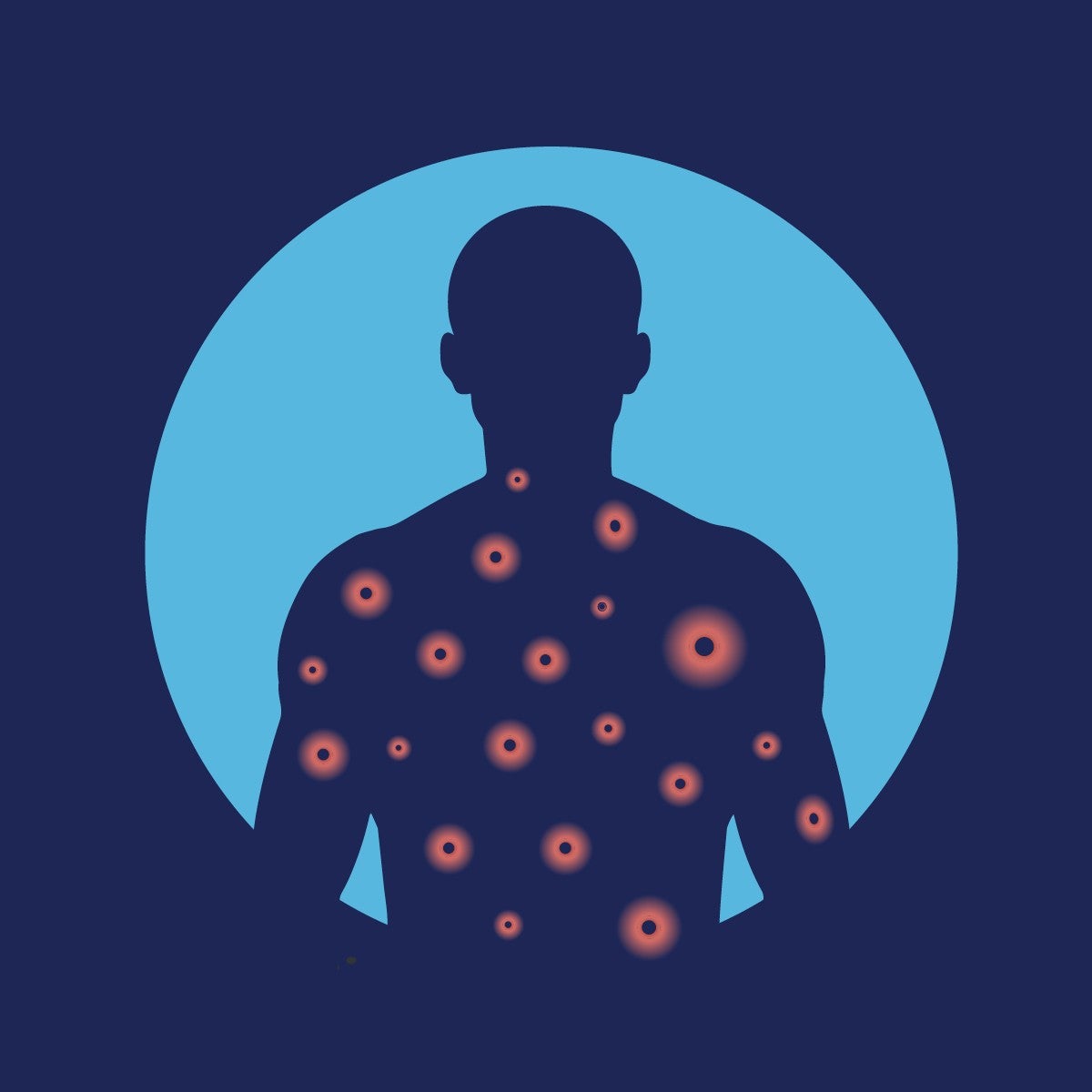 What You Need to Know About Measles | Lehigh Valley Health Network